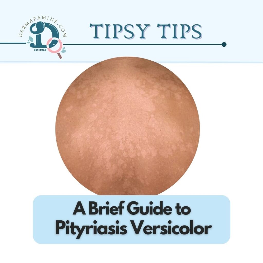 A Brief Guide to Pityriasis Versicolor — DERMAPAMINE by Dermapamine Club