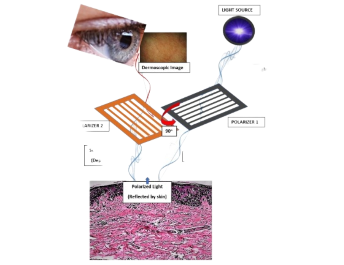 Dermoscopy — DERMAPAMINE by Dermapamine Club
