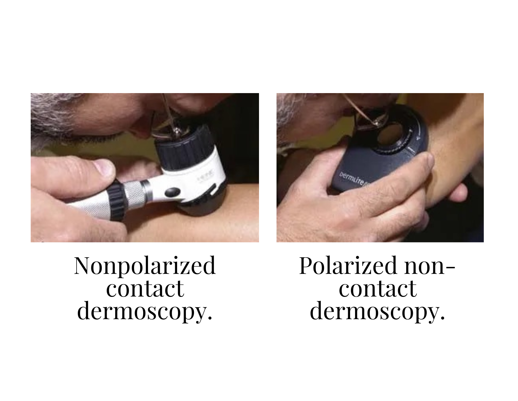 Dermoscopy — DERMAPAMINE by Dermapamine Club