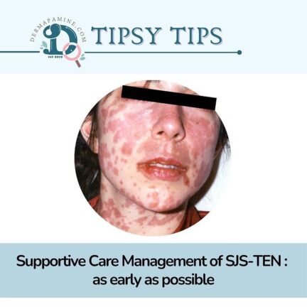 Supportive care management of sjs-ten : as early as possible ...